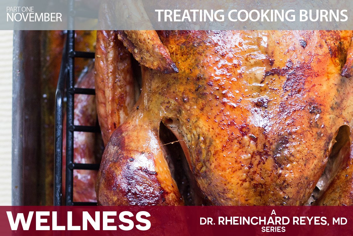 November: Treating Cooking Burns | Dr. Rheinchard Reyes MDPA